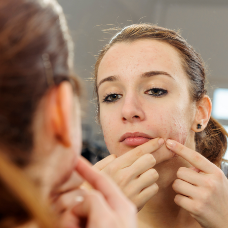 Understanding the Comedogenic Rating Scale – Ivy & Fields